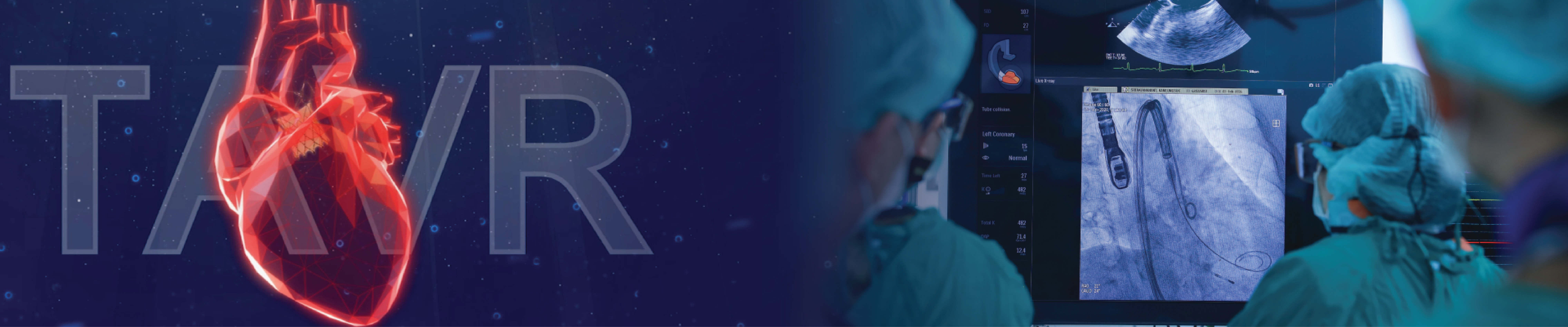 หัวใจและหลอดเลือด